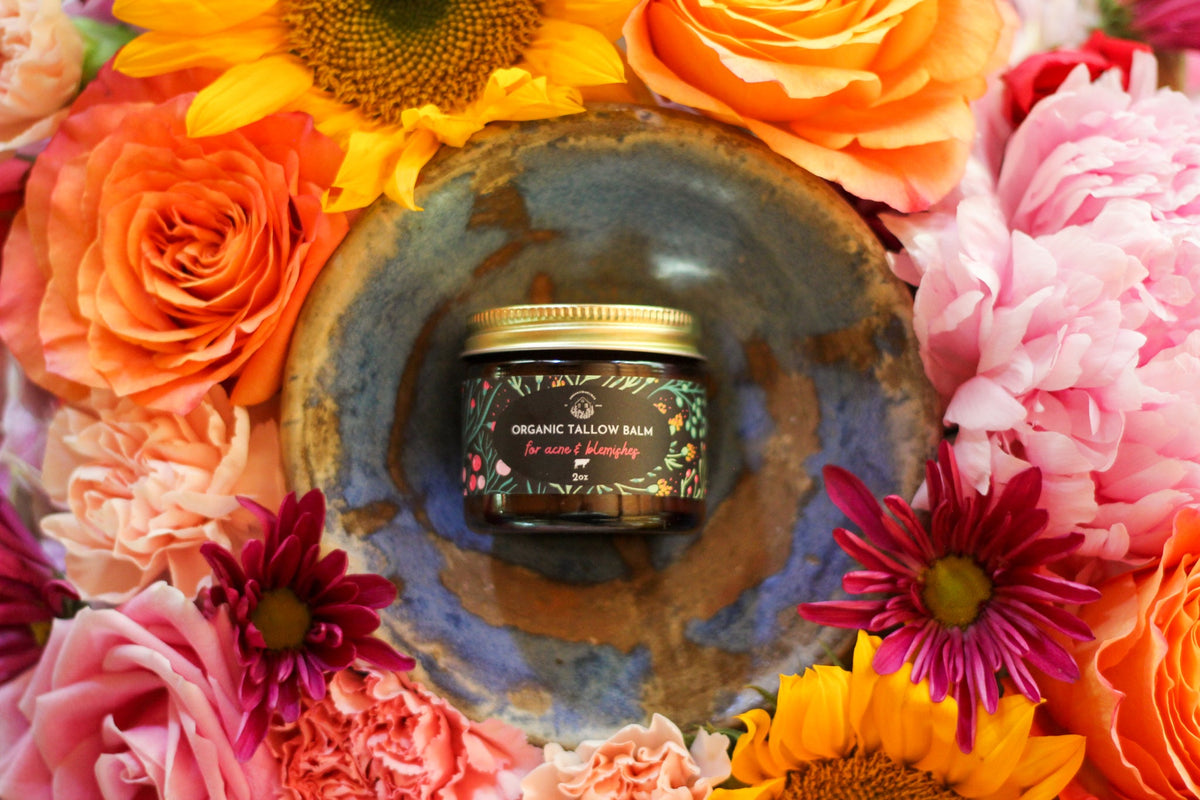 Organic Tallow Balm for Acne & Blemishes by OrganicDarlings
